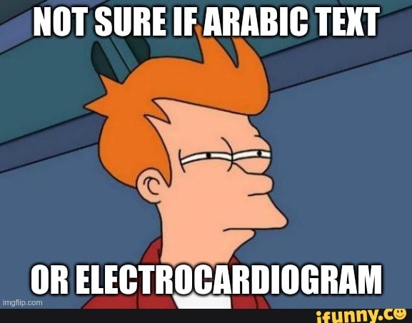 Electrocardiogram memes. Best Collection of funny Electrocardiogram ...