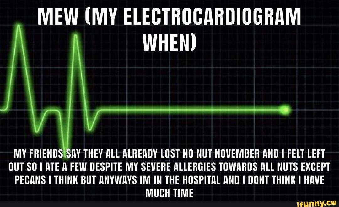 Electrocardiogram memes. Best Collection of funny Electrocardiogram ...