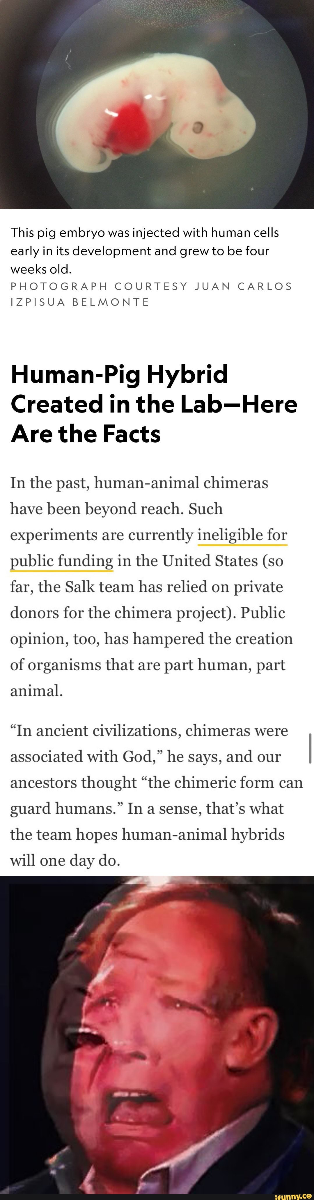 This pig embryo was injected with human cells early in its development ...