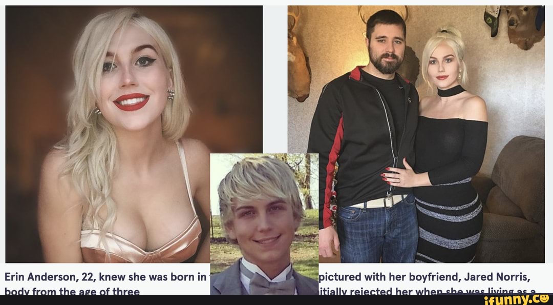 Erin Anderson, 22, knew she was born in pictured with her boyfriend, Jared Norris, - iFunny Brazil