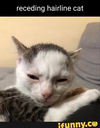Receding Hairline Meme - Infoupdate.org