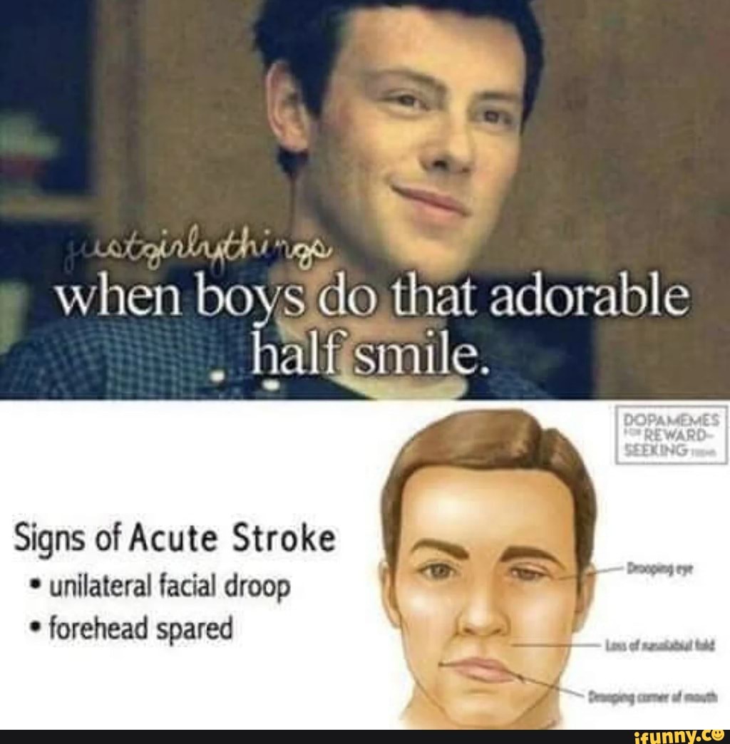 When boys do that adorable smile. Signs of Acute Stroke unilateral ...
