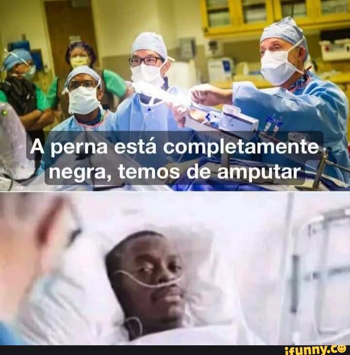 Perna está completamente negra, temos de amputar - iFunny Brazil
