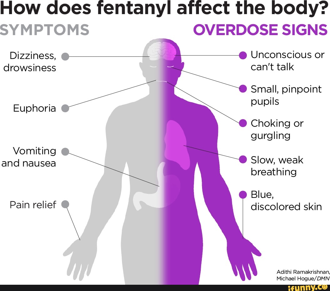 How does fentanyl affect the body? SYMPTOMS OVERDOSE SIGNS Dizziness ...