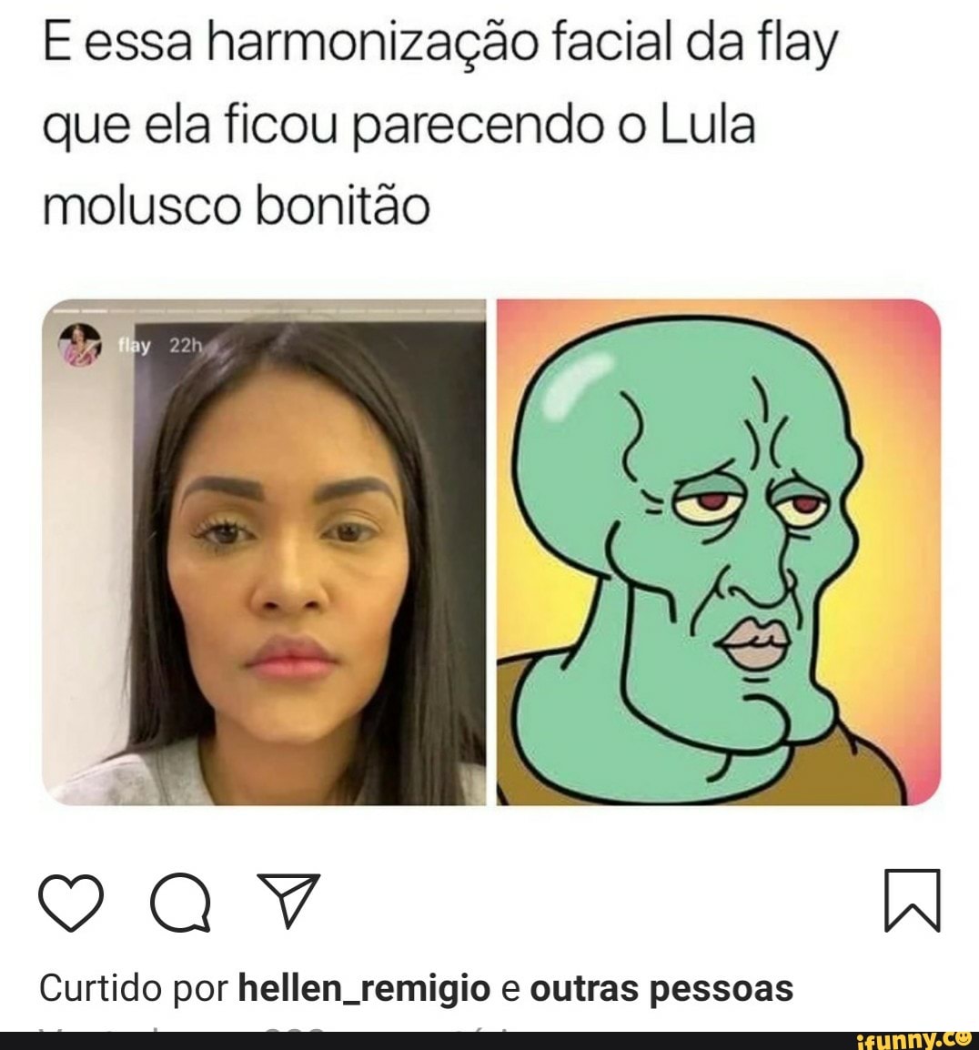 E essa harmonização facial da flay que ela ficou parecendo o Lula ...