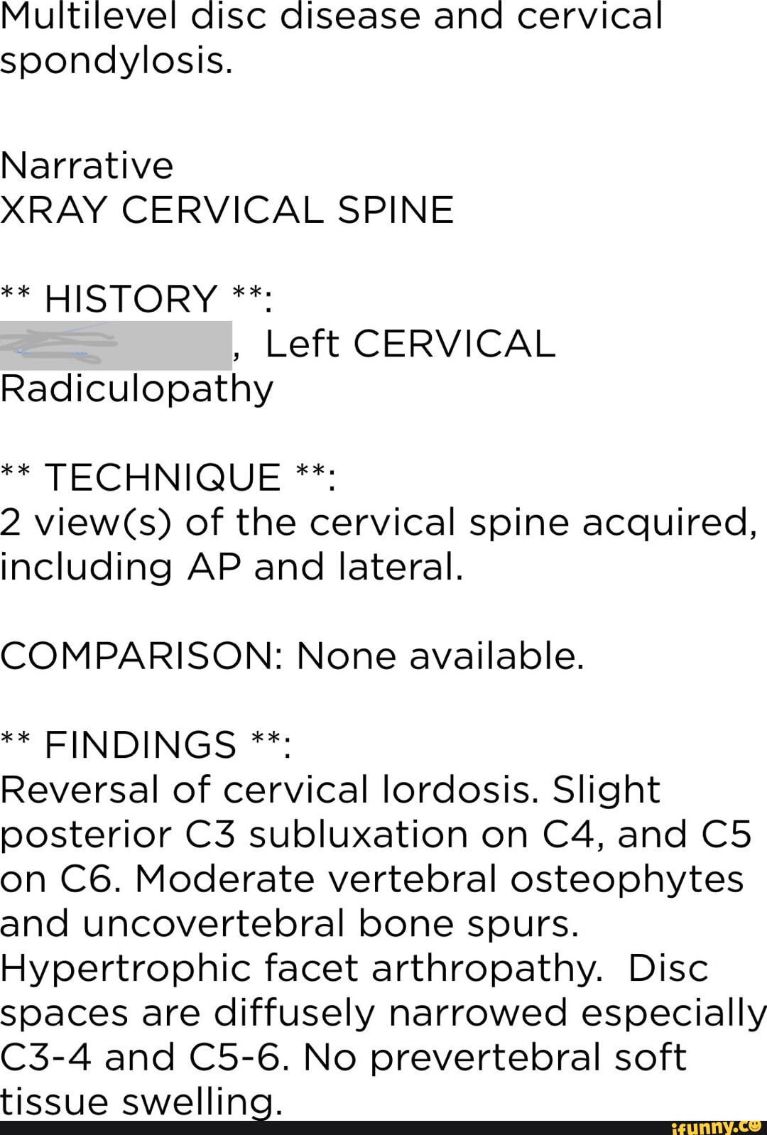 Multilevel disc disease and cervical spondylosis. Narrative XRAY ...