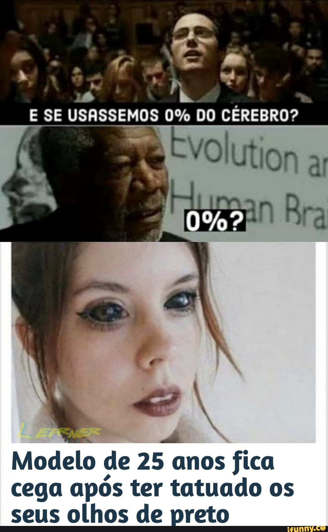 MM SE USASSEMOS 0% DO CÉREBRO? Modelo de 25 anos fica cega após ter ...