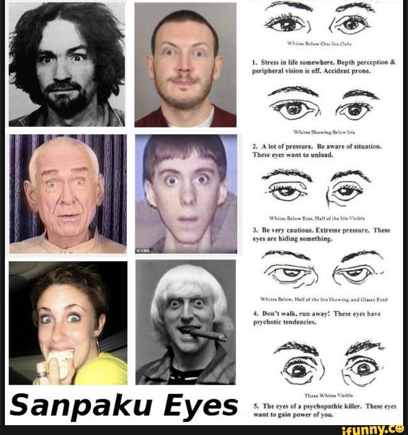 Sanpaku Eyes Eyes 1. Stress in life somewhere. Depth perception ...